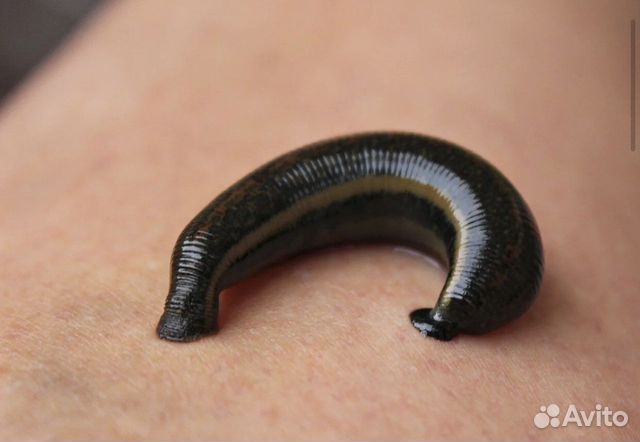 Пиявки медицинские